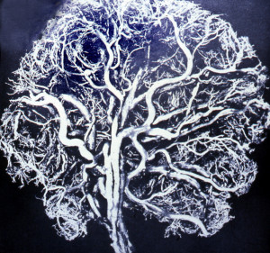 Active Birth Centre - Precious Placenta - Active Birth Centre