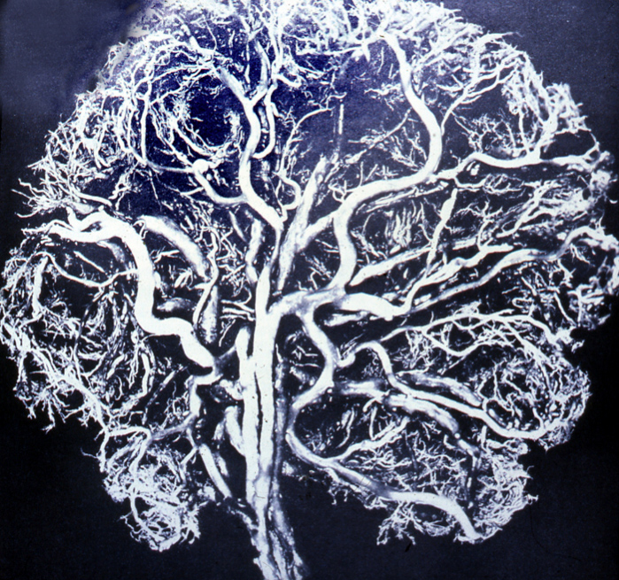 Active Birth Centre - Precious Placenta - Active Birth Centre